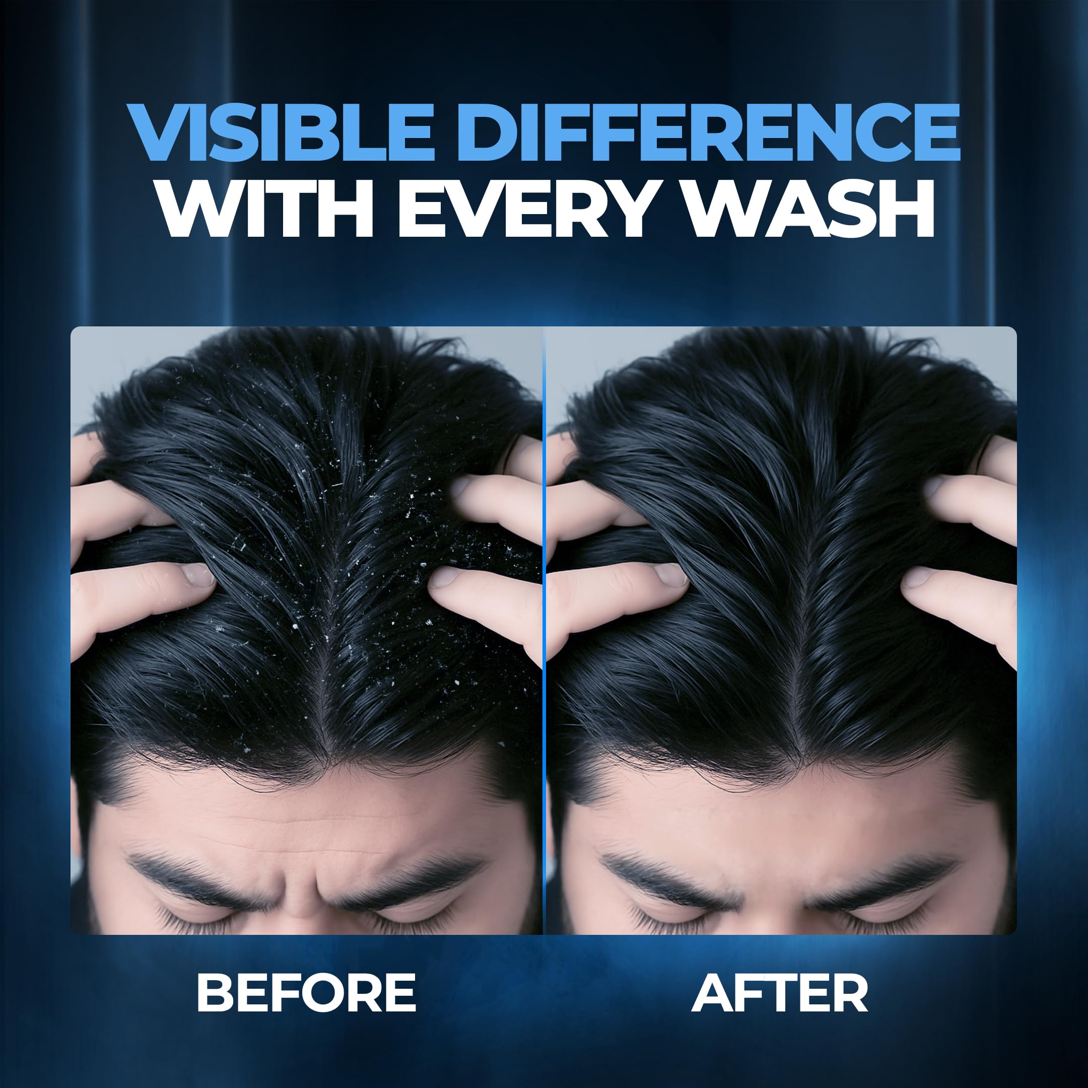 Beardo Dandruff Control Sulphate Free Shampoo for men 200 ml | Anti ...